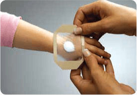 How To Apply Emla Cream - Emla